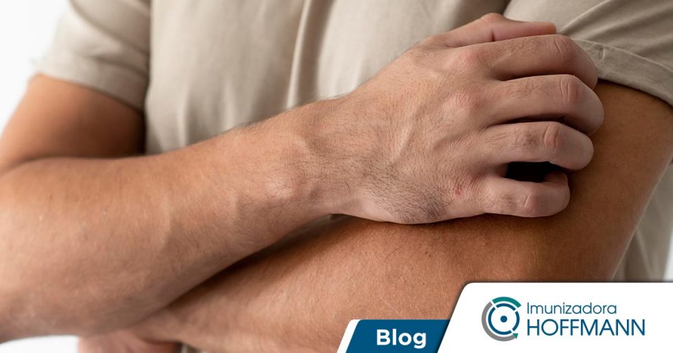 Pulgas em humanos: como identificar, tratar e evitar picadas